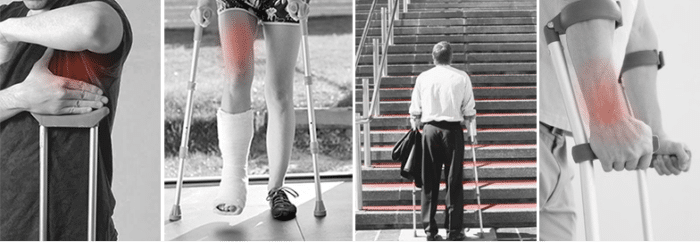 The Best Crutch Substitute: Introducing the iWALK Crutch