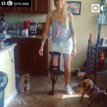 iWALKFree Hands-Free Crutch for Walking – Better Than Crutches or Knee ...