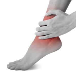 Avulsion Fracture of the Ankle: Symptoms, Causes, Treatment & Recovery