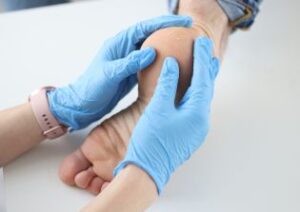 Broken Heel: Symptoms, Causes, Treatments, Surgery & Recovery